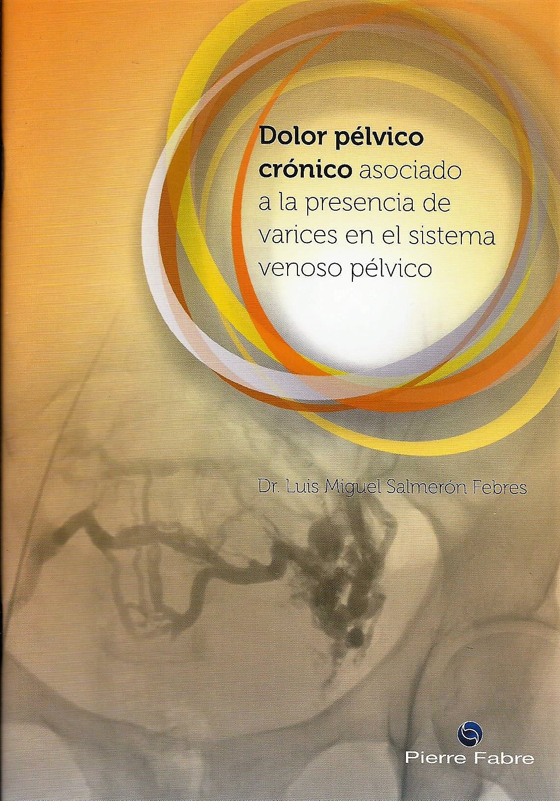 Dolor pélvico crónico asociado a varices | Blog de Tomás Cabacas