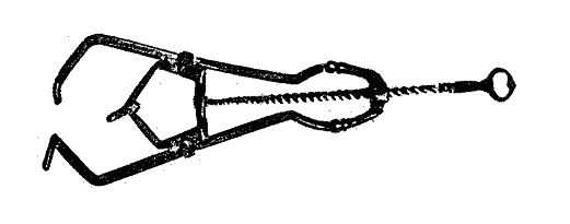 Espéculo de Scultetus. Siglo XVII | Blog de Tomás Cabacas