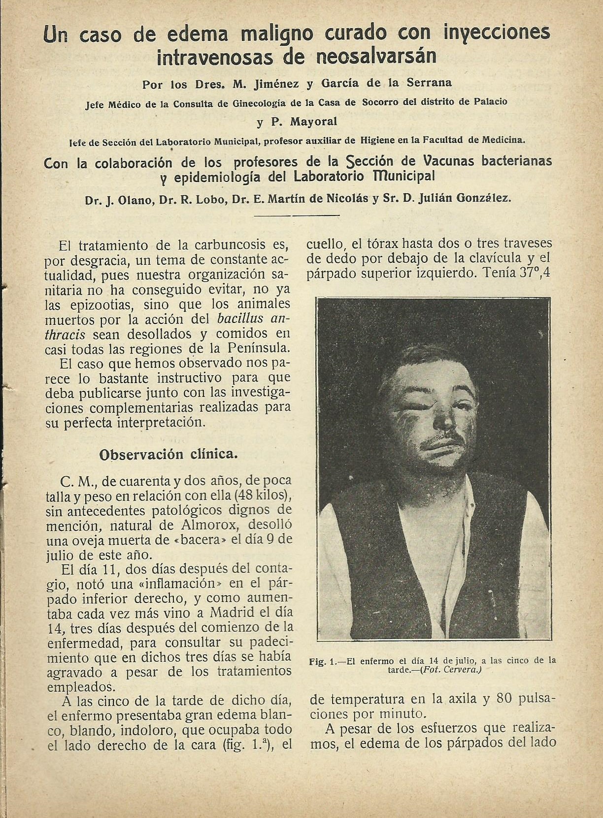 Edema maligno curado con neosalvarsán | Blog de Tomás Cabacas