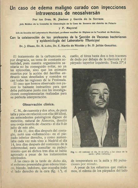 Edema maligno curado con neosalvarsán | Blog de Tomás Cabacas