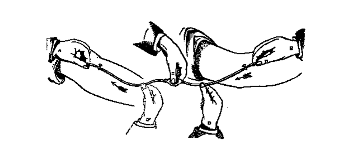 Transfusor de Aveling | Blog de Tomás Cabacas
