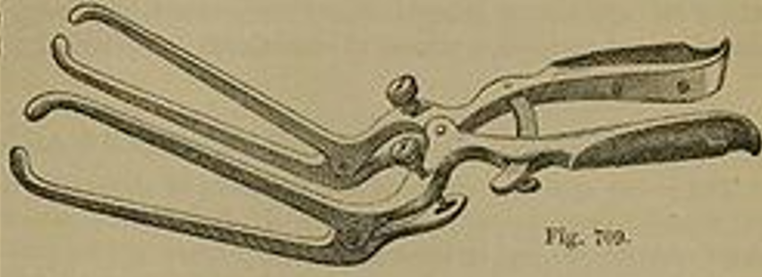 Espéculo vaginal de Edward Zeis | Blog de Tomás Cabacas