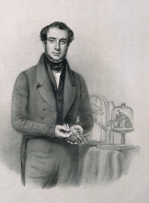 Espéculo vaginal de Samuel A. Lane | Blog de Tomás Cabacas