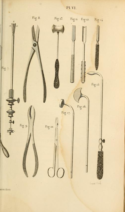 Instrumentos médicos para realizar resecciones quirúrgicas en el Siglo ...